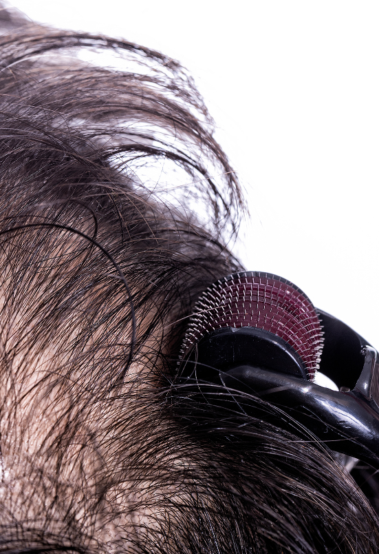 Best Dermatologist in Rohini, Delhi - Varun Jain